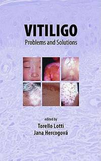 Vitiligo: Problems And Solutions (Basic And Clinical Dermatology) by ...