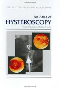 An Atlas Of Hysteroscopy: A Guide To Diagnosis (Encyclopedia Of Visual ...