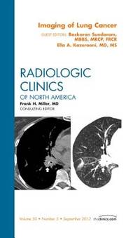 Imaging of Lung Cancer: An Issue of Radiologic Clinics of North America ...