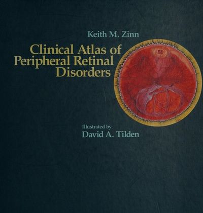 Clinical Atlas of Peripheral Retinal Disorders by Zinn, Keith M ...
