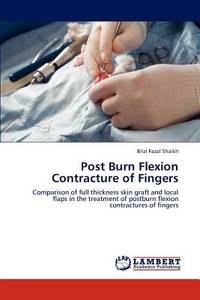 Post Burn Flexion Contracture of Fingers: Comparison of full thickness ...