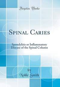 Spinal Caries: Spondylitis or Inflammatory Disease of the Spinal Column ...