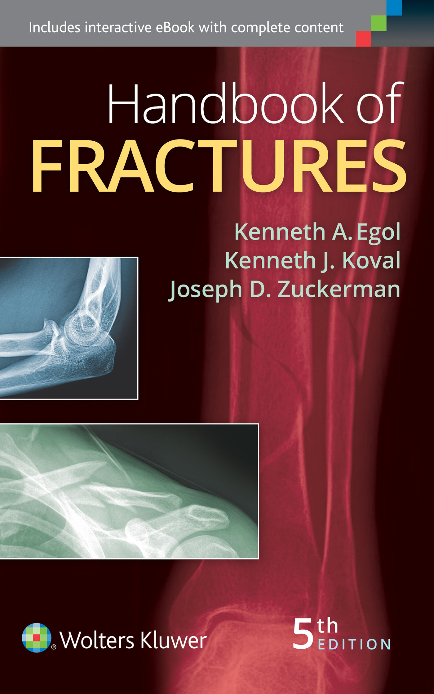 Handbook Of Fractures by Kenneth Egol by Kenneth Egol | Paperback ...
