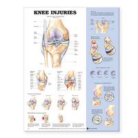 Knee Injuries Anatomical Chart by Anatomical Chart Company - Wal Chrt ...