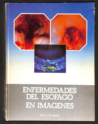 Enfermedades del esofago en imagen by Prof. J. Ferrando | 1990 ...