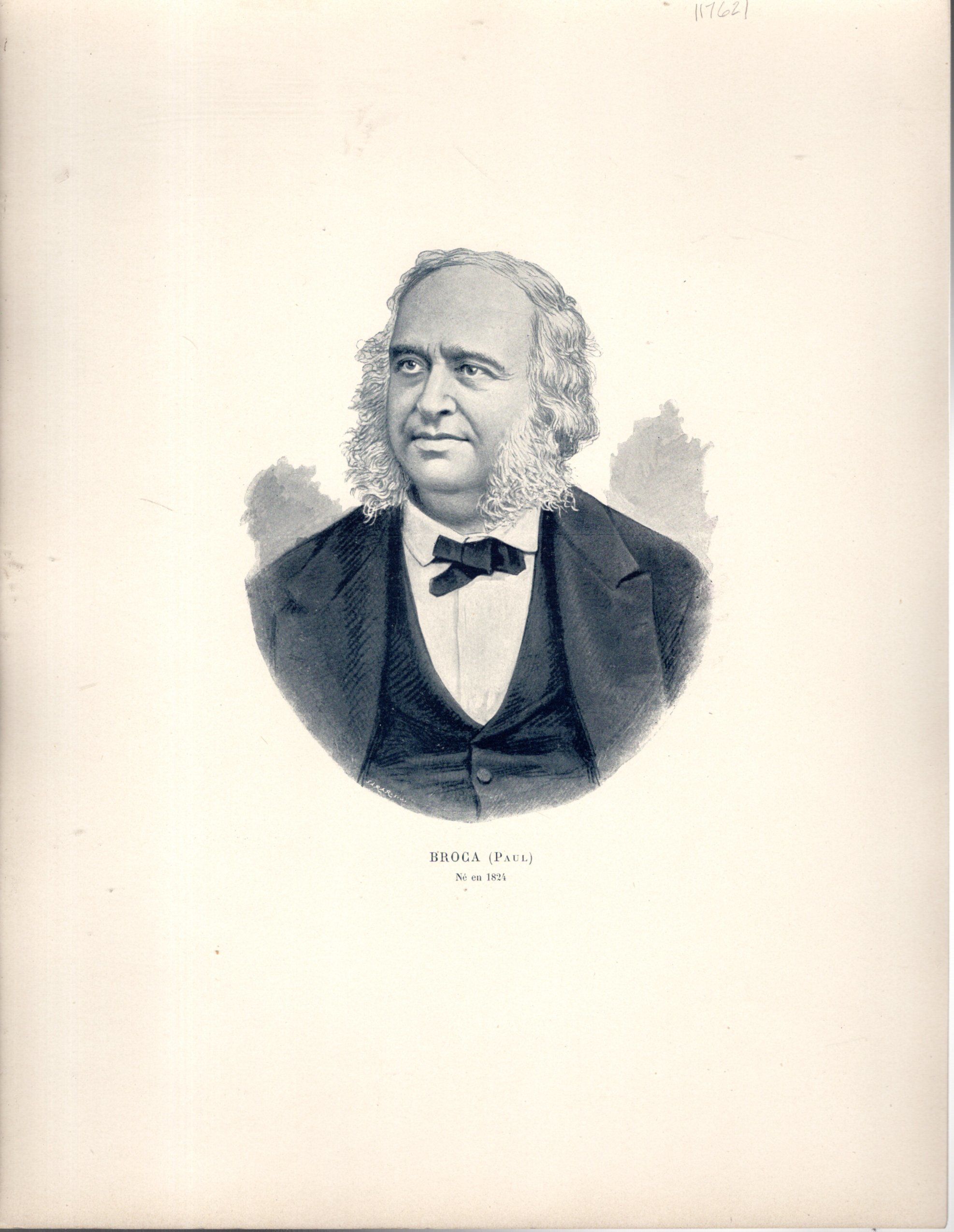 BIBLIO | ENGRAVING: "Broca (Paul) ne' en 1824"...from the Centenaire de ...