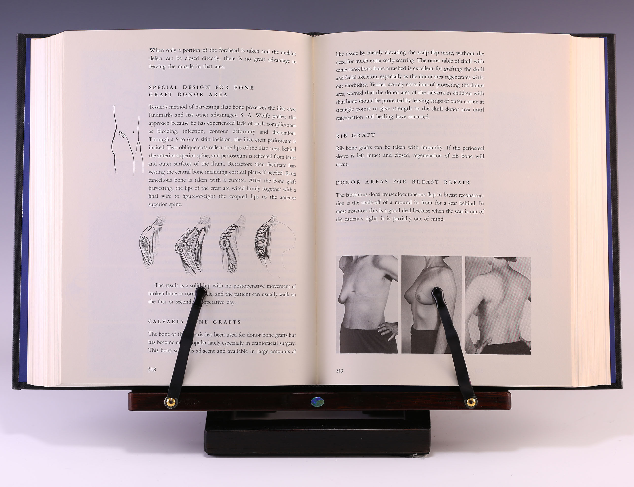 Principlization of Plastic Surgery by D. Ralph Millard | Hardcover ...