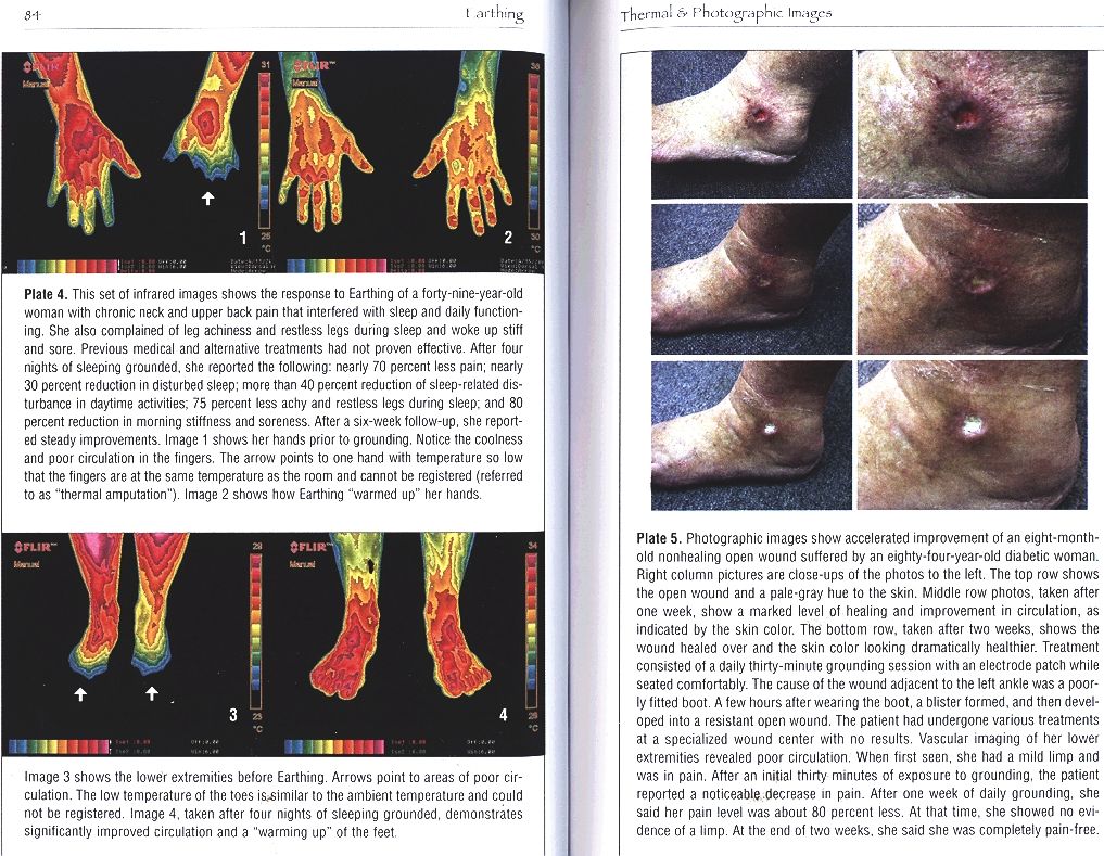 Earthing: The Most Important Health Discovery Ever! [Electrical You and ...
