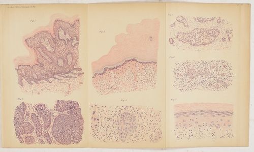 BIBLIO | Ueber den Einfluss der Röntgenstrahlen auf epitheliale Gewebe ...