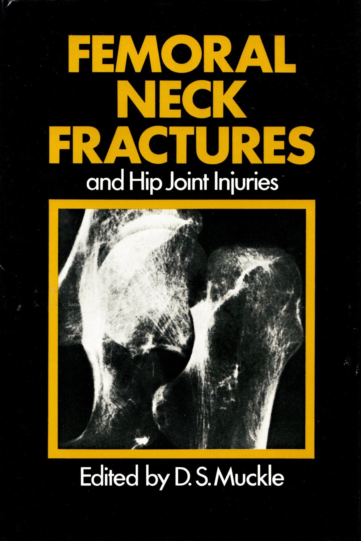 Femoral neck fractures and hip joint injuries by Muckle, David ...