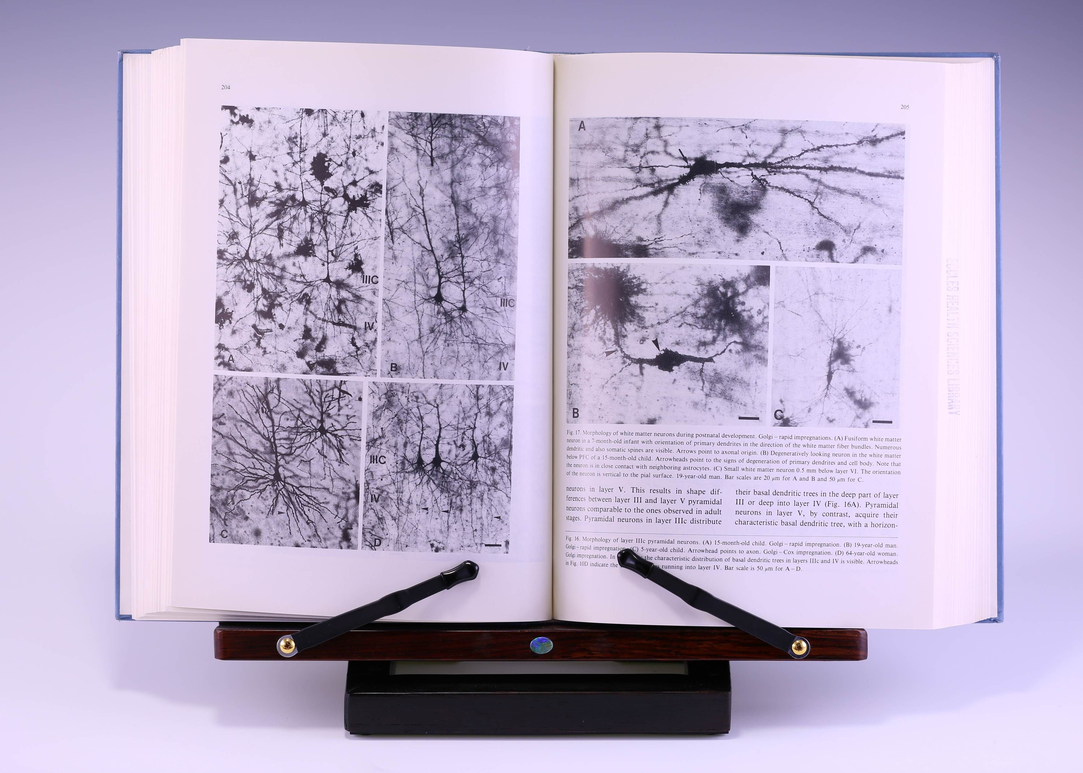 The Prefrontal Cortex: Its Structure, Function and Pathology (Progress ...