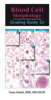 Blood Cell Morphology Grading Guide by Gene Gulati - from The Saint ...