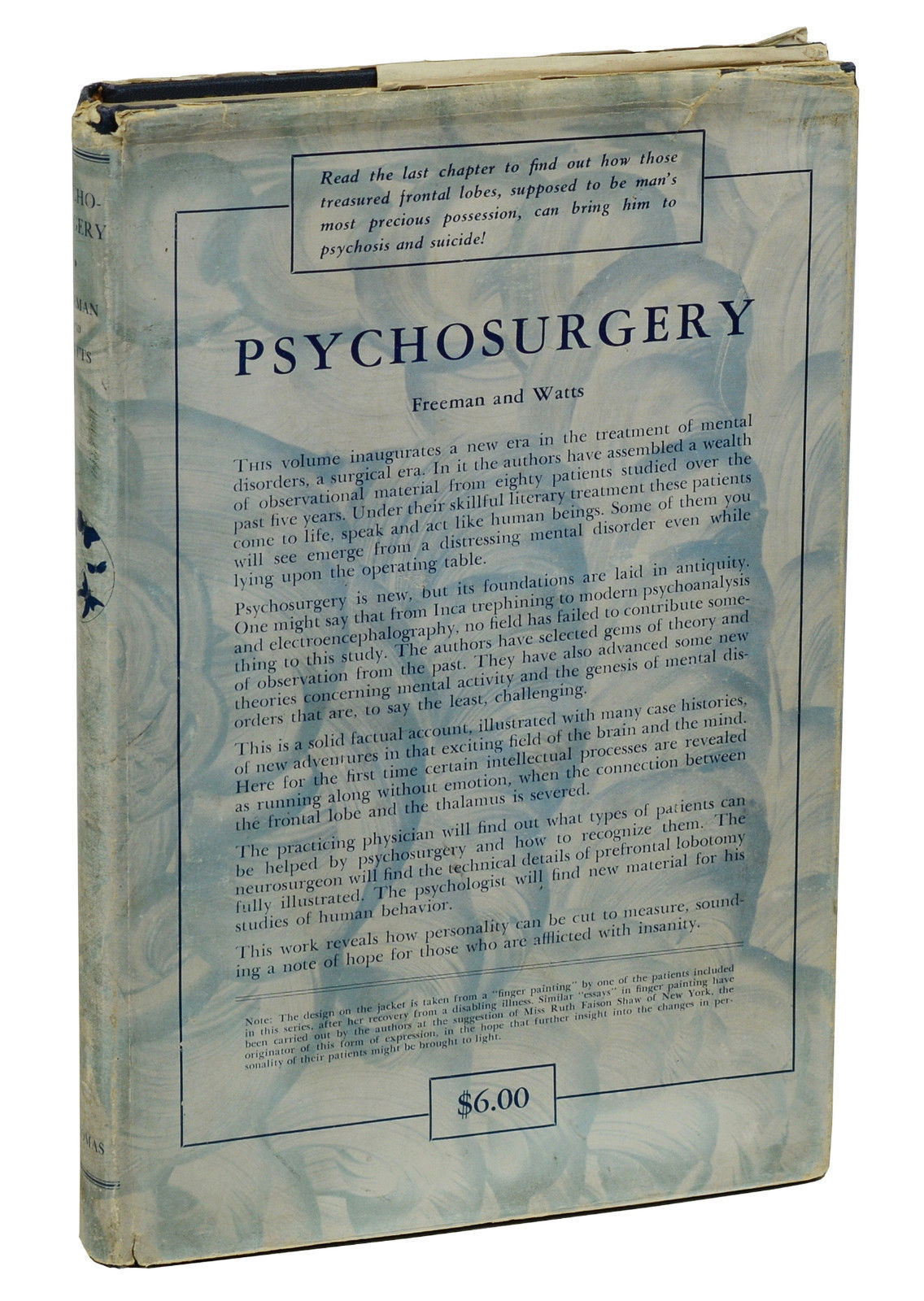 Psychosurgery